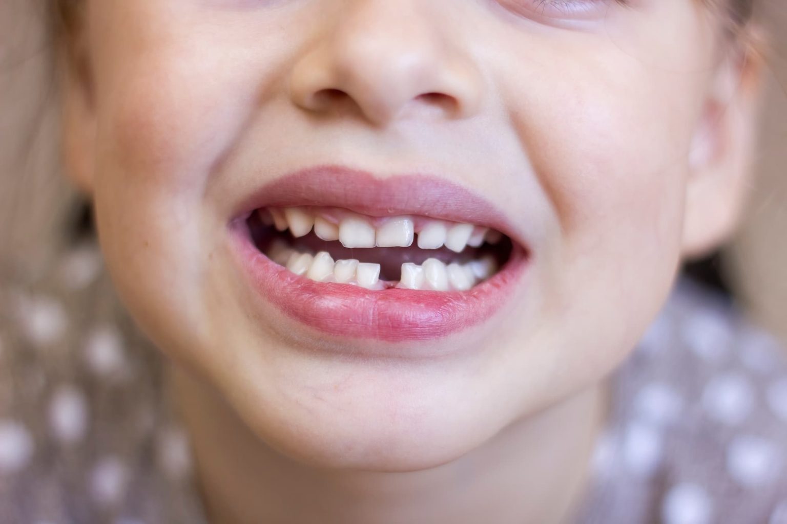Emergency Dental | Newport Family Dentist