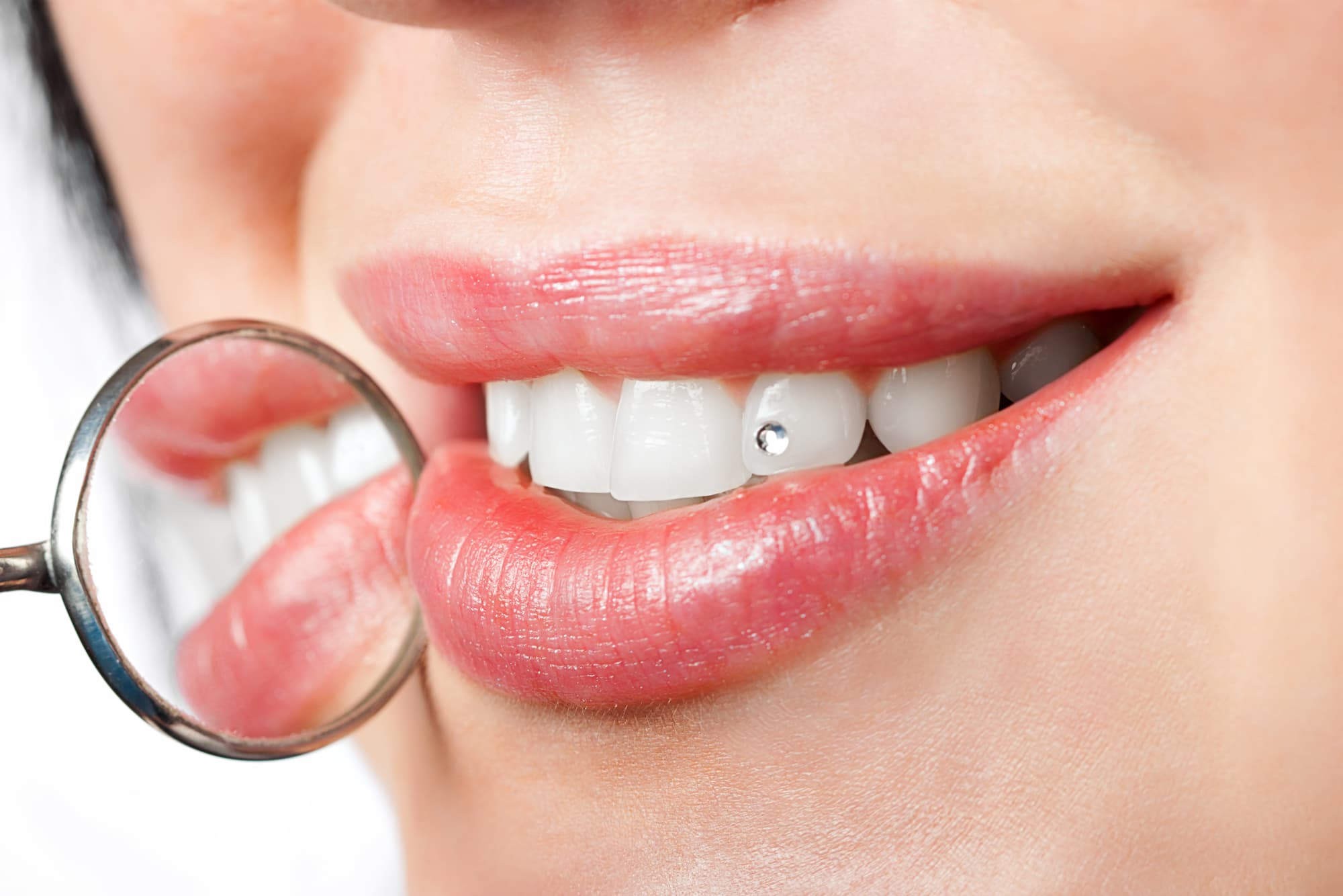 Dental Crystals | Newport Family Dentist