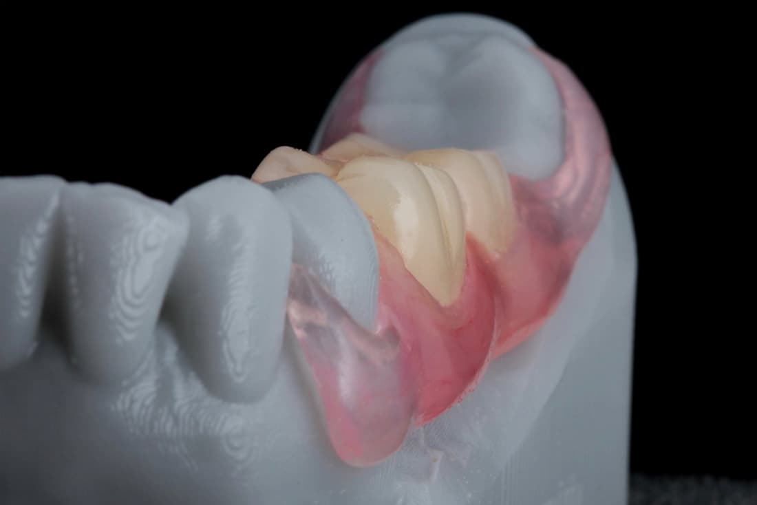 Partial & Complete Dentures | Newport Family Dentist
